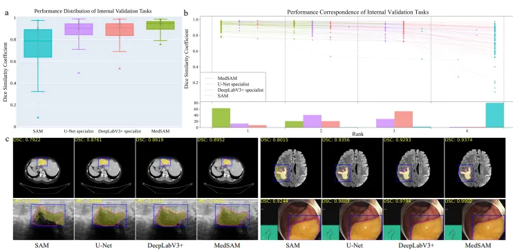 一个AI看懂所有医学影像！MedSAM打造医学图像分割的“全能助手”-腾讯云开发者社区-腾讯云