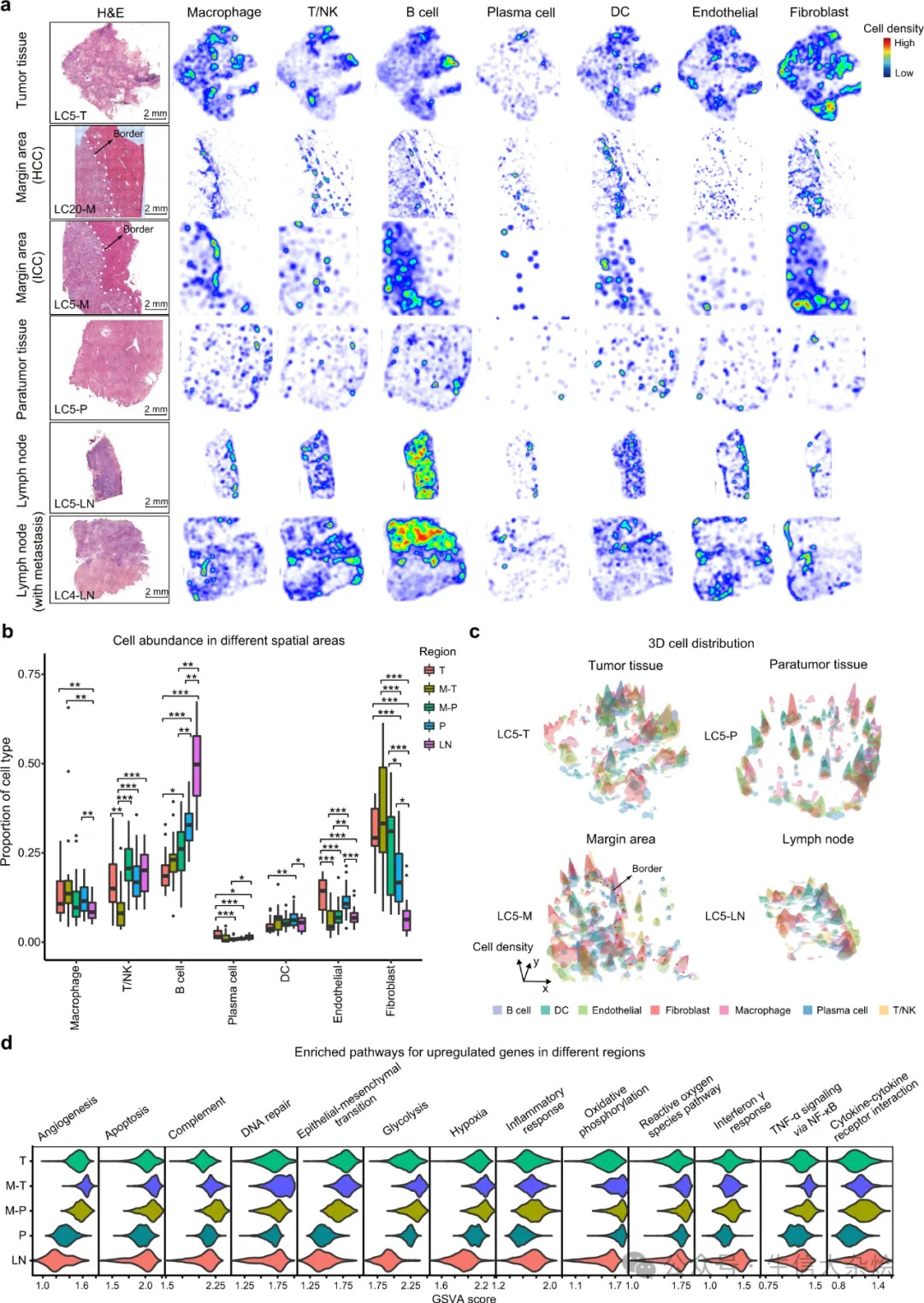 Cell Res | Stereo-seq揭示人类肝癌浸润区促进肝细胞-肿瘤细胞串扰、局部免疫抑制和肿瘤进展-腾讯云开发者社区-腾讯云