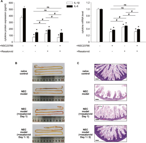AbMole丨综述：免疫调控的关键靶点--Toll样受体（TLR），及其常用抑制剂/激动剂全解析-腾讯云开发者社区-腾讯云