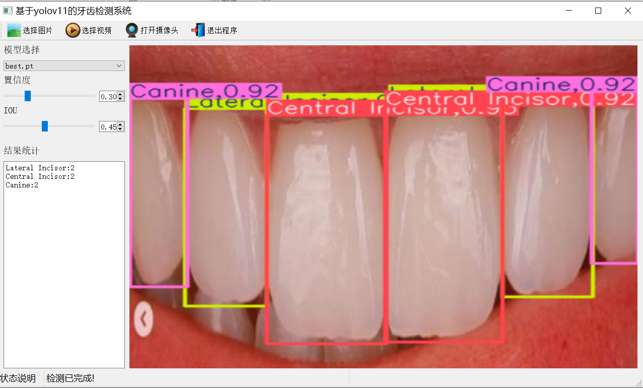 基于yolov11的牙齿检测系统python源码+pytorch模型+评估指标曲线+精美GUI界面-腾讯云开发者社区-腾讯云