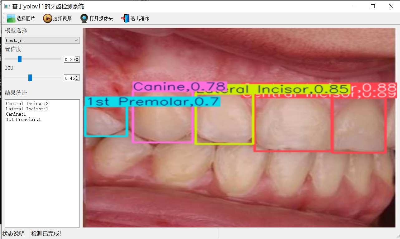 基于yolov11的牙齿检测系统python源码+pytorch模型+评估指标曲线+精美GUI界面-腾讯云开发者社区-腾讯云