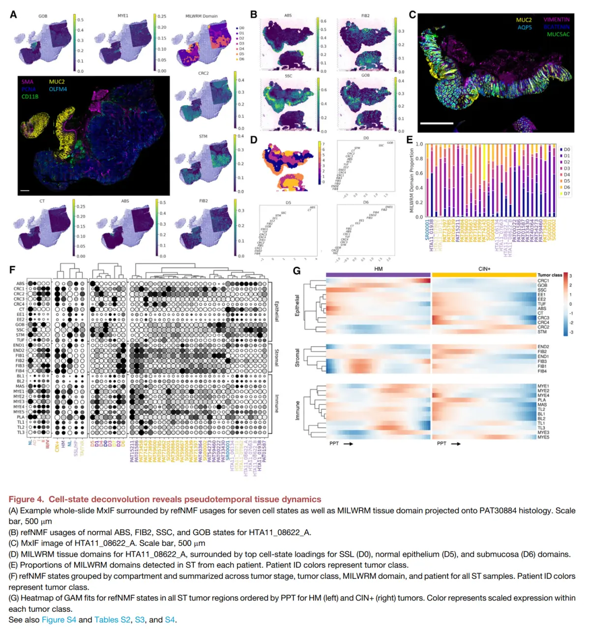 10X单细胞、空间、WES测序分析揭示肿瘤微环境进化区域异质性-腾讯云开发者社区-腾讯云