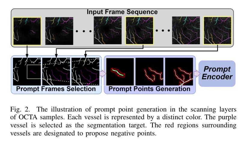 SAM-OCTA2 一种高效的OCTA图像层序列与投影分割方法 ！-腾讯云开发者社区-腾讯云