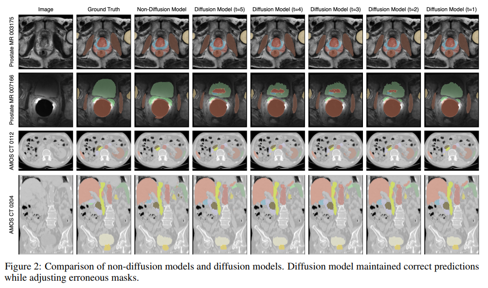 ImgX-DiffSeg：基于 DDPMs 的 3D 医学图像分割-腾讯云开发者社区-腾讯云
