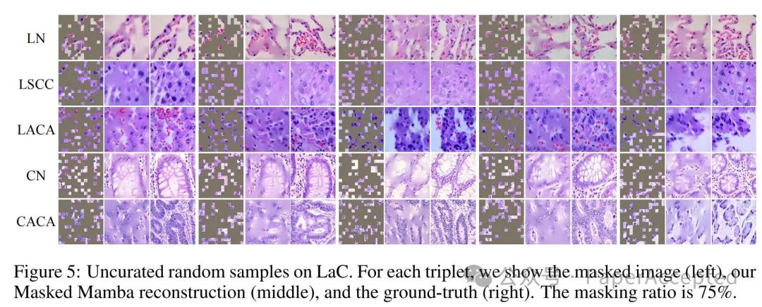 Masked Mamba: 基于Mamba的病理图像分类的自监督框架-腾讯云开发者社区-腾讯云