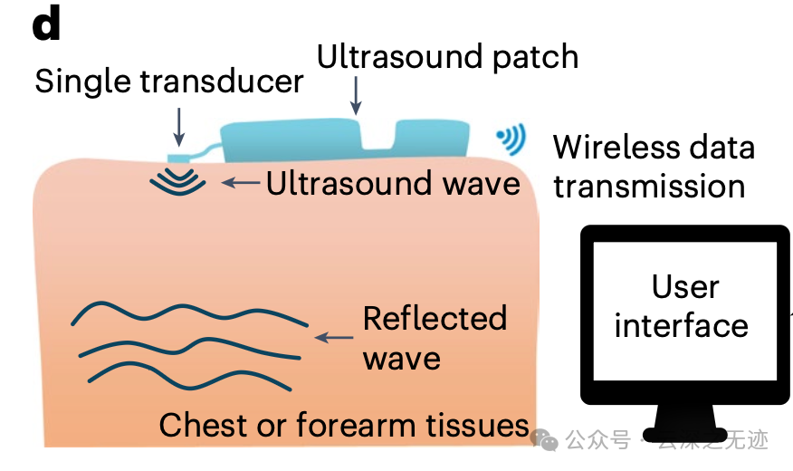 新型可穿戴超声肌电（Echomyography, EcMG）系统硬件设计（带一丢丢软件）-腾讯云开发者社区-腾讯云