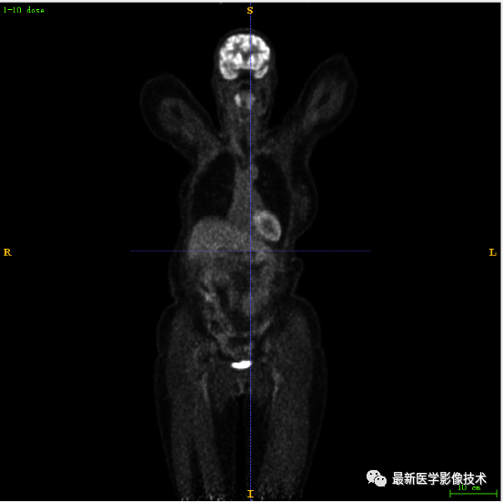 Ultra-low Dose PET2022——超低剂量PET成像挑战-腾讯云开发者社区-腾讯云