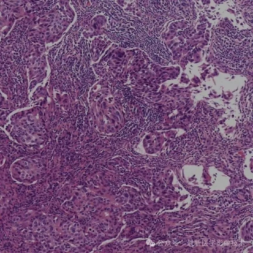 BCI2022——乳腺癌免疫组织化学图像生成挑战-腾讯云开发者社区-腾讯云