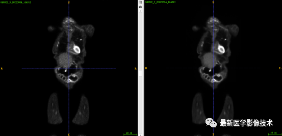 Ultra-low Dose PET2022——超低剂量PET成像挑战-腾讯云开发者社区-腾讯云