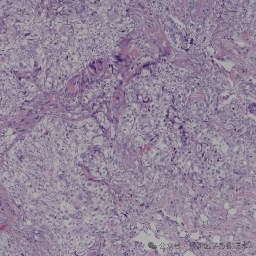 BCI2022——乳腺癌免疫组织化学图像生成挑战-腾讯云开发者社区-腾讯云