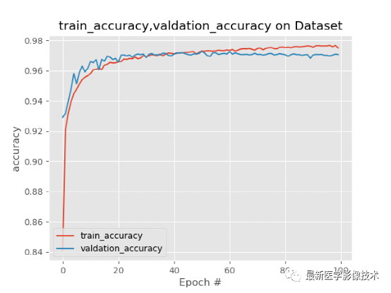 2018Medical Segmentation Decathlon——10项医学分割任务之task3肝脏肿瘤分割-腾讯云开发者社区-腾讯云