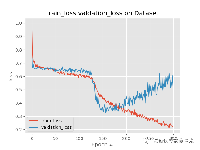 LNDb2020——肺结节自动诊断分析-腾讯云开发者社区-腾讯云