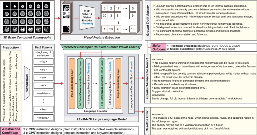 Nat. Commun. | AI写的CT报告能骗过真医生？BrainGPT诊断准确率超七成-腾讯云开发者社区-腾讯云