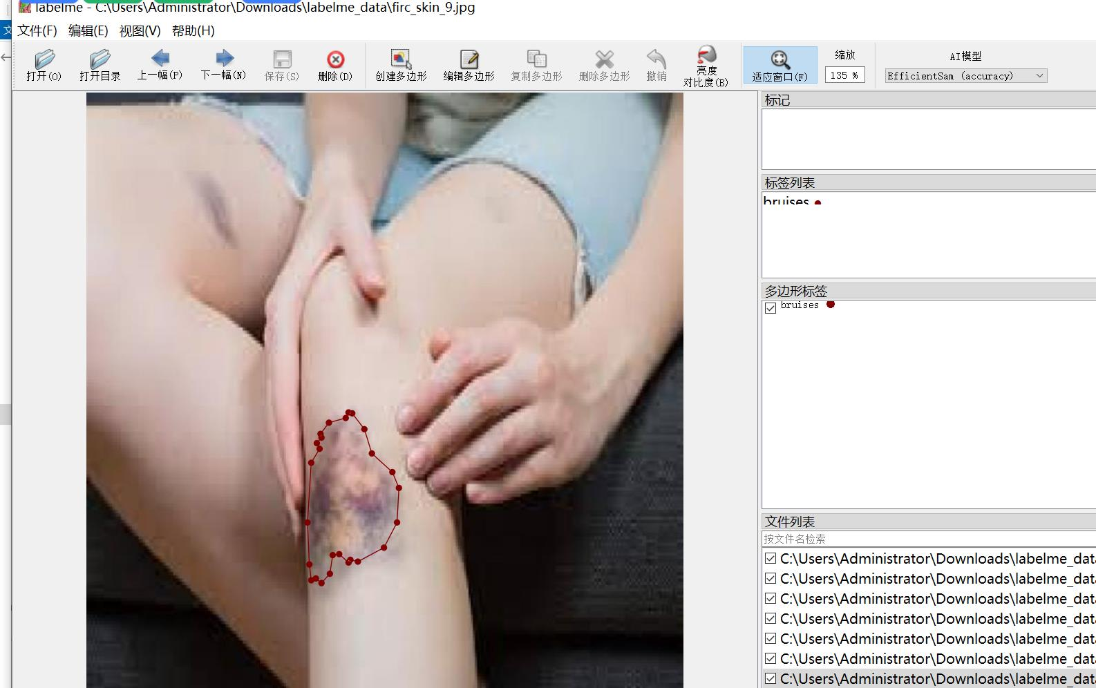 皮肤伤口分割数据集labelme格式248张5类别-腾讯云开发者社区-腾讯云