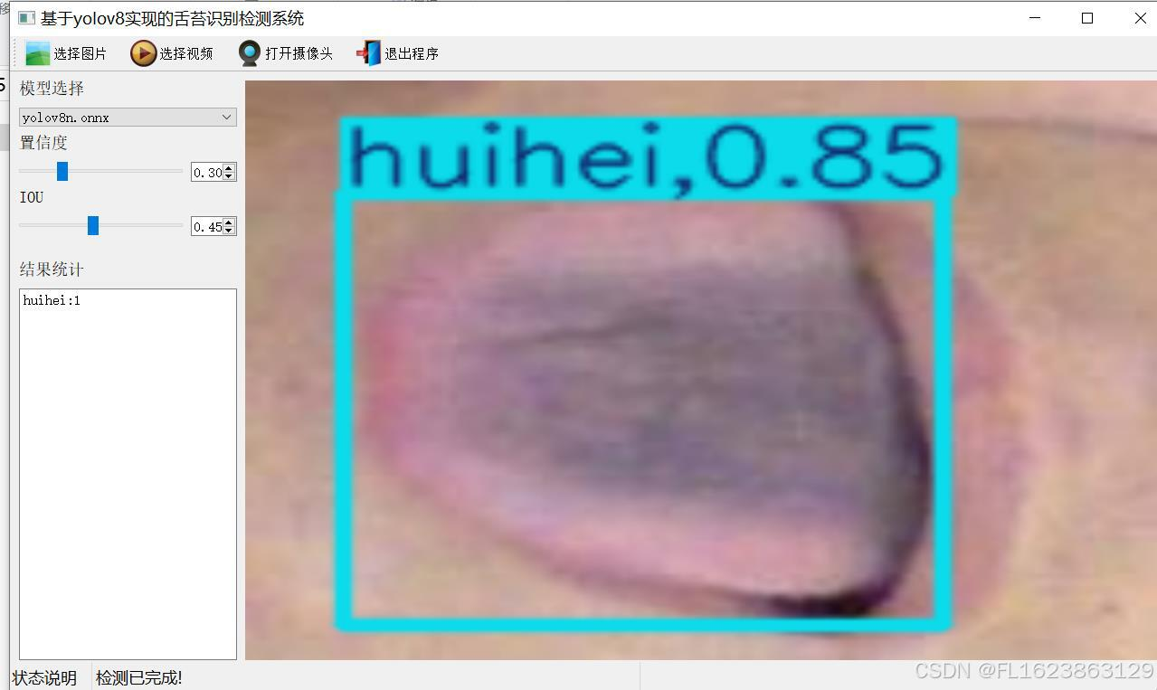基于yolov8的舌苔识别检测系统python源码+onnx模型+评估指标曲线+精美GUI界面-腾讯云开发者社区-腾讯云
